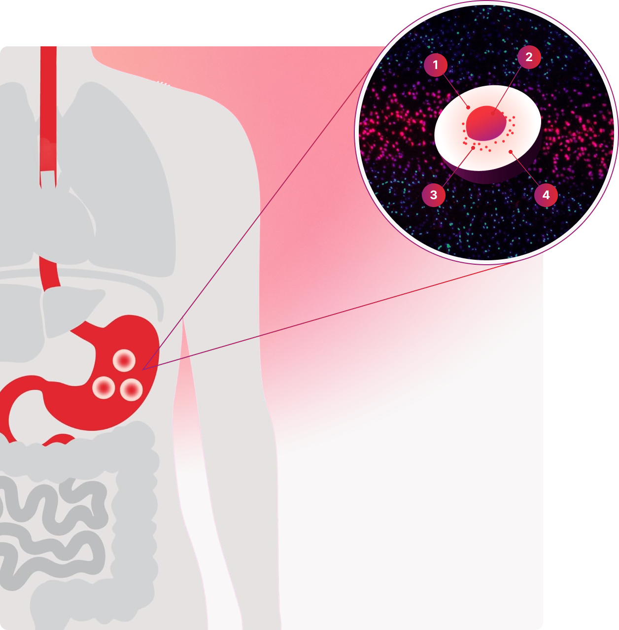 The Science Behind SiderAL®: Patented Sucrosomial® Iron – PharmaNutra