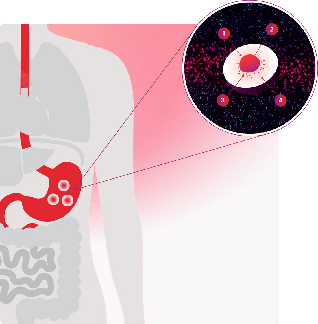 The Science Behind SiderAL®: Patented Sucrosomial® Iron – PharmaNutra